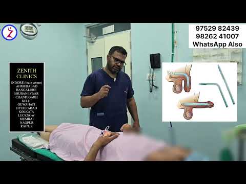 Penile Implant Surgery In Indore Gwalior Ujjain Ratlam Dewas Rewa Satna Jabalpur 