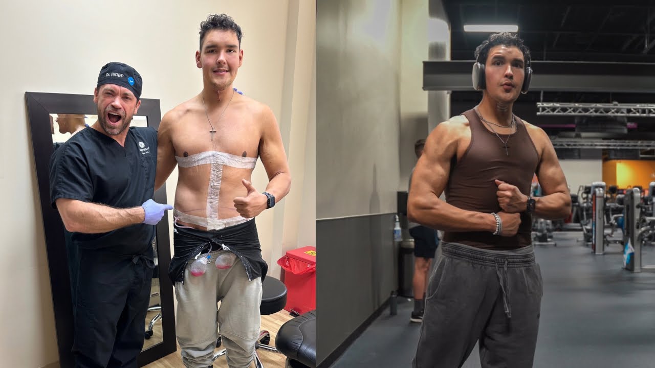 FIRST DAY BACK IN THE GYM FROM SURGERY - YouTube