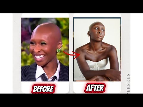 SHOCKING 😳 Cynthia Erivo Before and After Looks transformation | Ariana ...