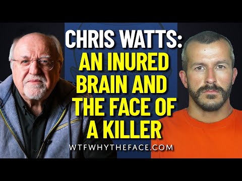 Dr. Todd Analyzes the Face of Chris Watts: When You Mix a Brain Injury with Anger Issues