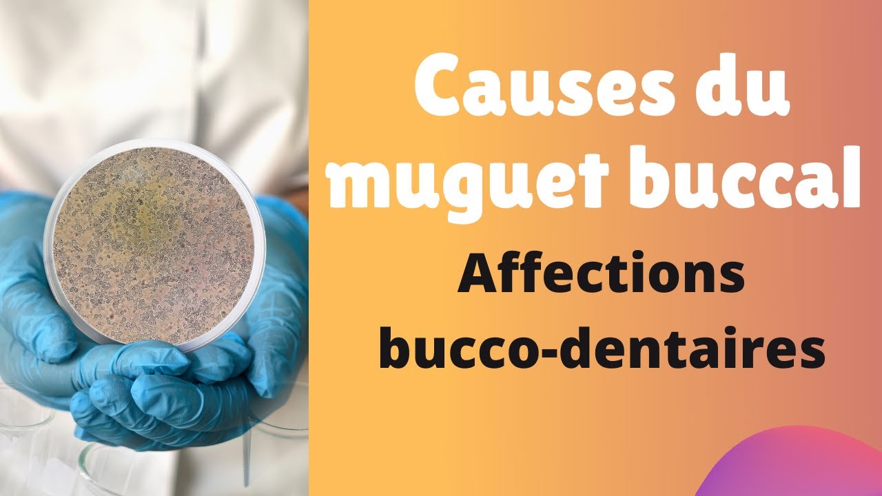 muguet buccal / maladies bucco-dentaires | candidose - YouTube