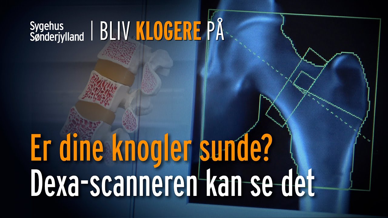 Er dine knogler sunde? - YouTube