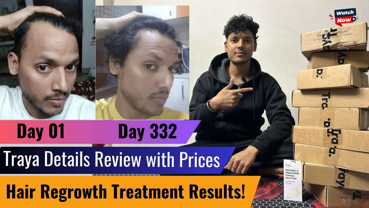 Traya Hair Review After 10th Months | Traya Honest Review | Traya ...