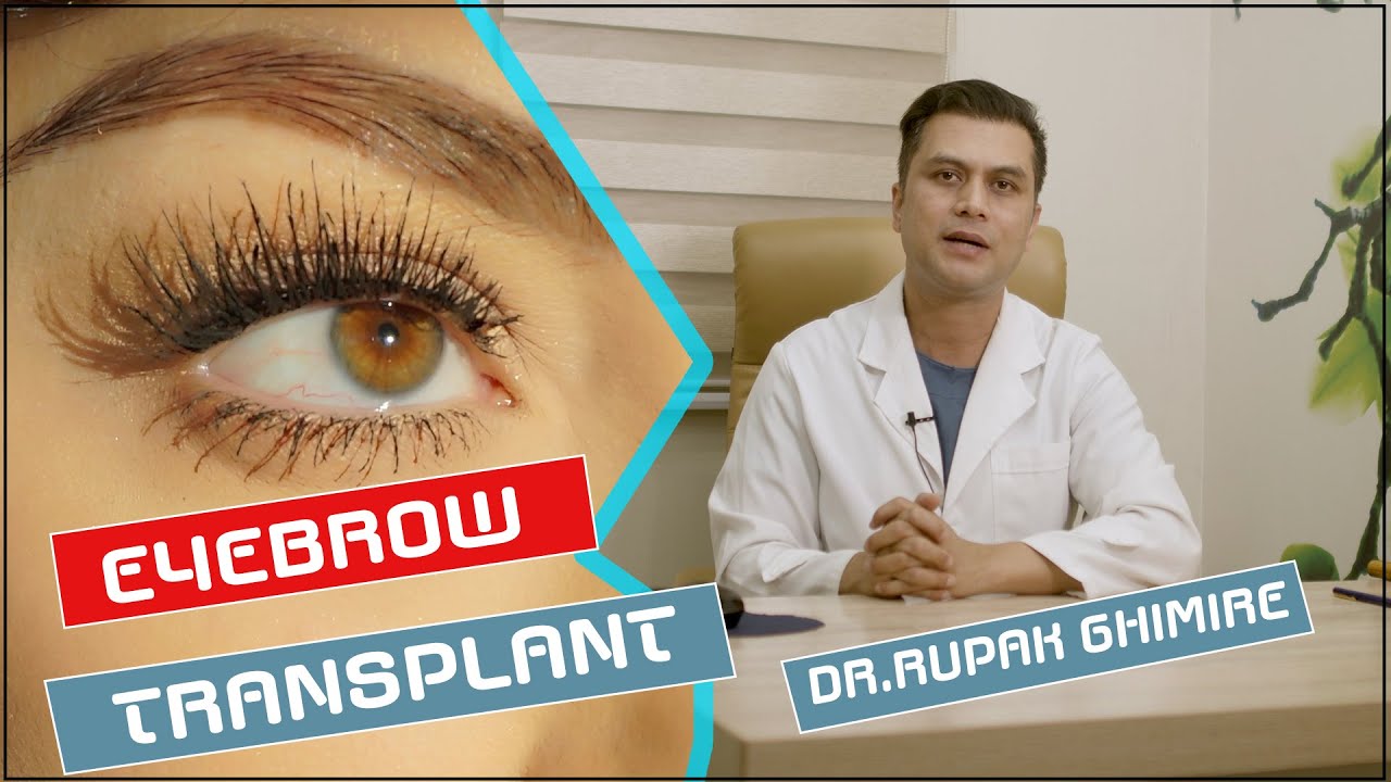 आईब्रो ट्रांसप्लांट || Eyebrow Transplantation || Dr.Rupak Ghimire ...