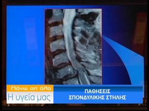ΠΑΘΗΣΕΙΣ ΣΠΟΝΔΥΛΙΚΗΣ ΣΤΗΛΗΣ Α' ΜΕΡΟΣ 19-05-2013 ΠΑΝΩ ΑΠ'ΟΛΑ Η ΥΓΕΙΑ ΜΑΣ ...
