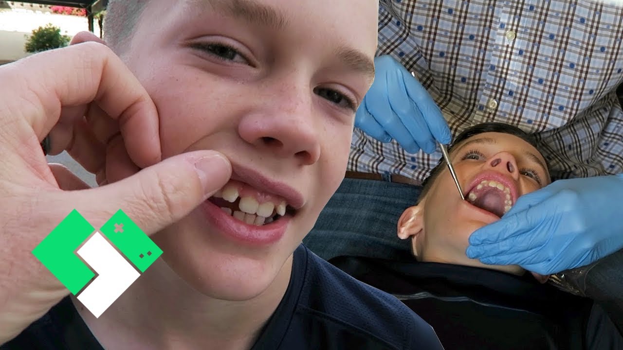 When Is Bryce Getting Braces?! | Clintus.tv - YouTube