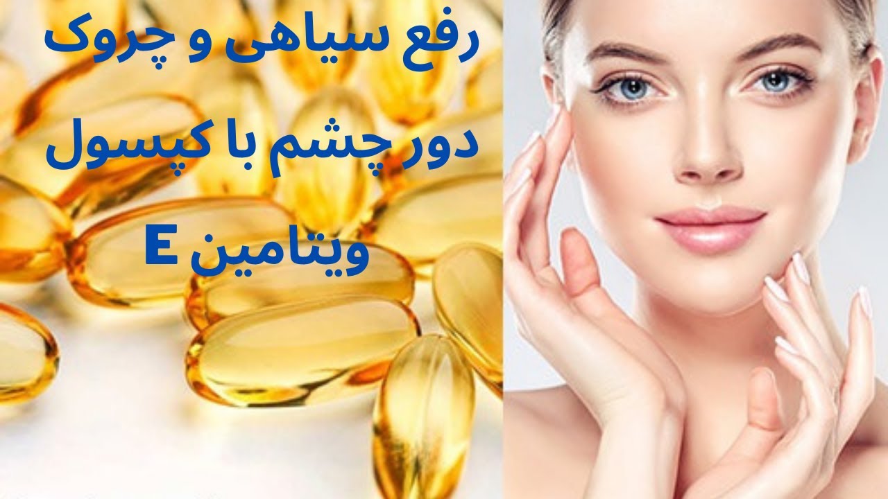 رفع سیاهی و چروک دور چشم چطوری با کپسول ویتامین E سیاهی و چروک دور چشم