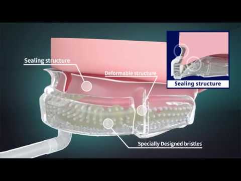 3-D animation of how the mouthpiece works inside the mouth. - YouTube
