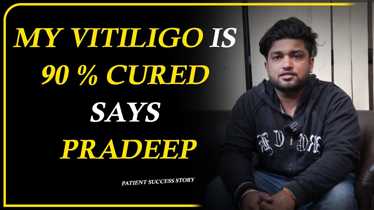 Safed Daag Ka Ilaaj | Effective Vitiligo Treatment by Dr. Kanchan - YouTube