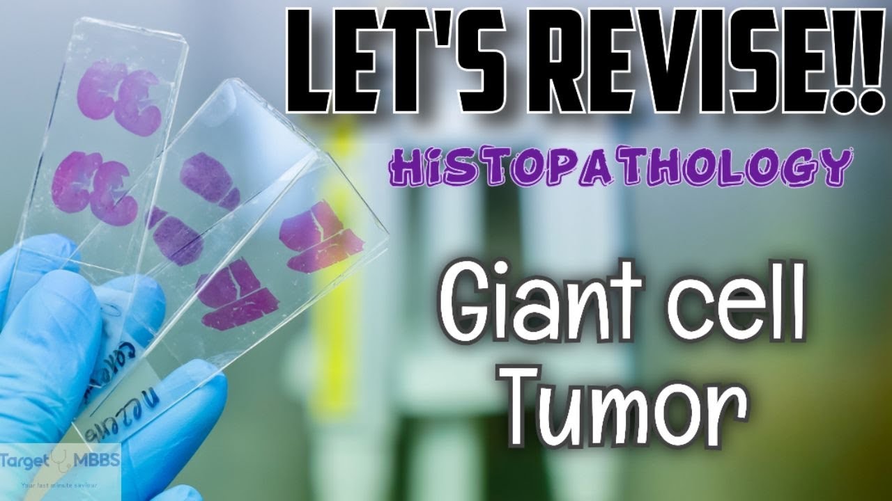 HISTOPATHOLOGY | GIANT CELL TUMOUR | Target MBBS | PATHOLOGY PRACTICAL ...