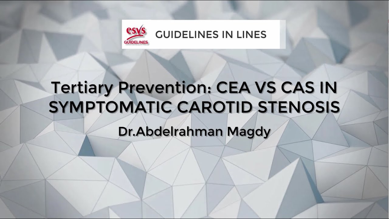 Guidelines In Lines "CEA VS CAS In Symptomatic Carotid Stenosis" - YouTube