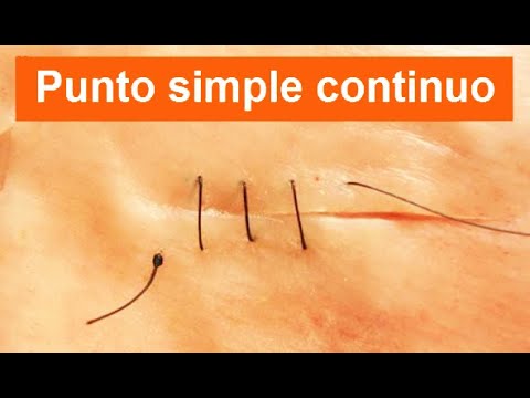 🔴 PUNTO DE SUTURA CONTINUO SIMPLE O SURGETE - YouTube