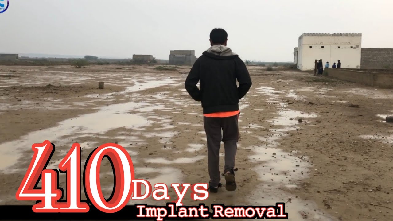 410 Days Complete 2 Implant Removal || Tibia Fibula Fracture Recovery ...