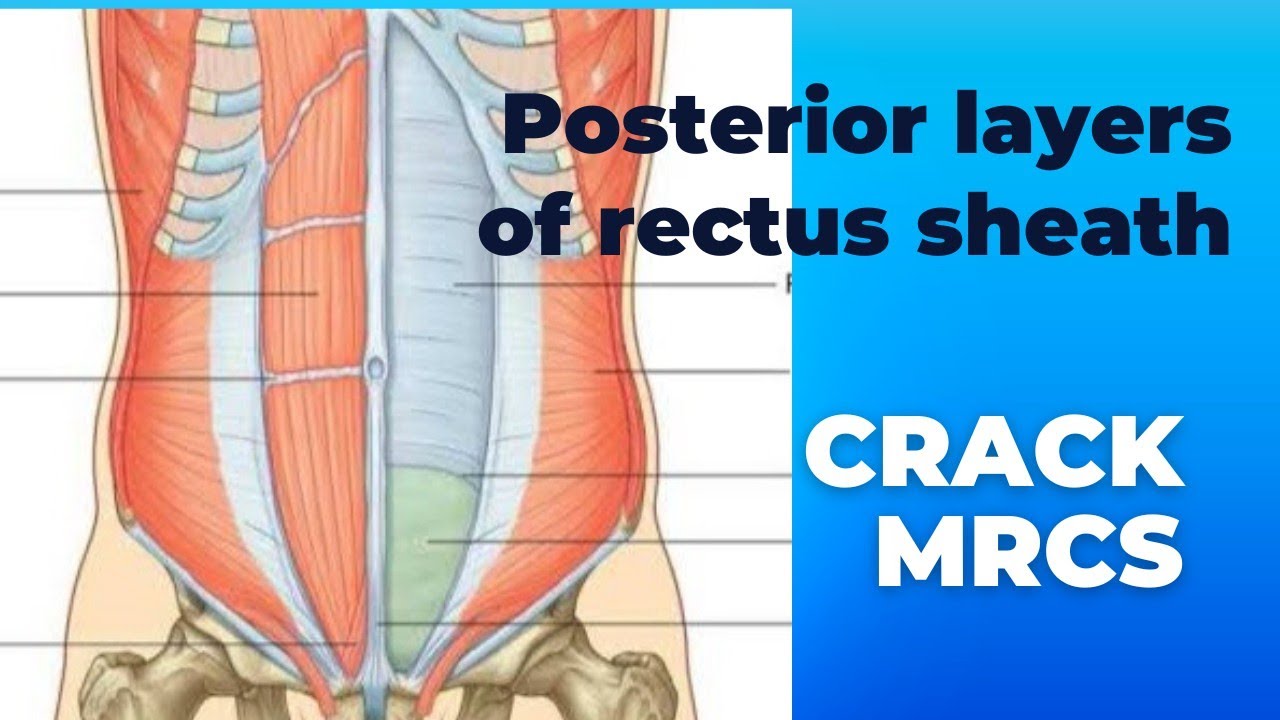 posterior layer of rectus sheath MRCS question solve - YouTube