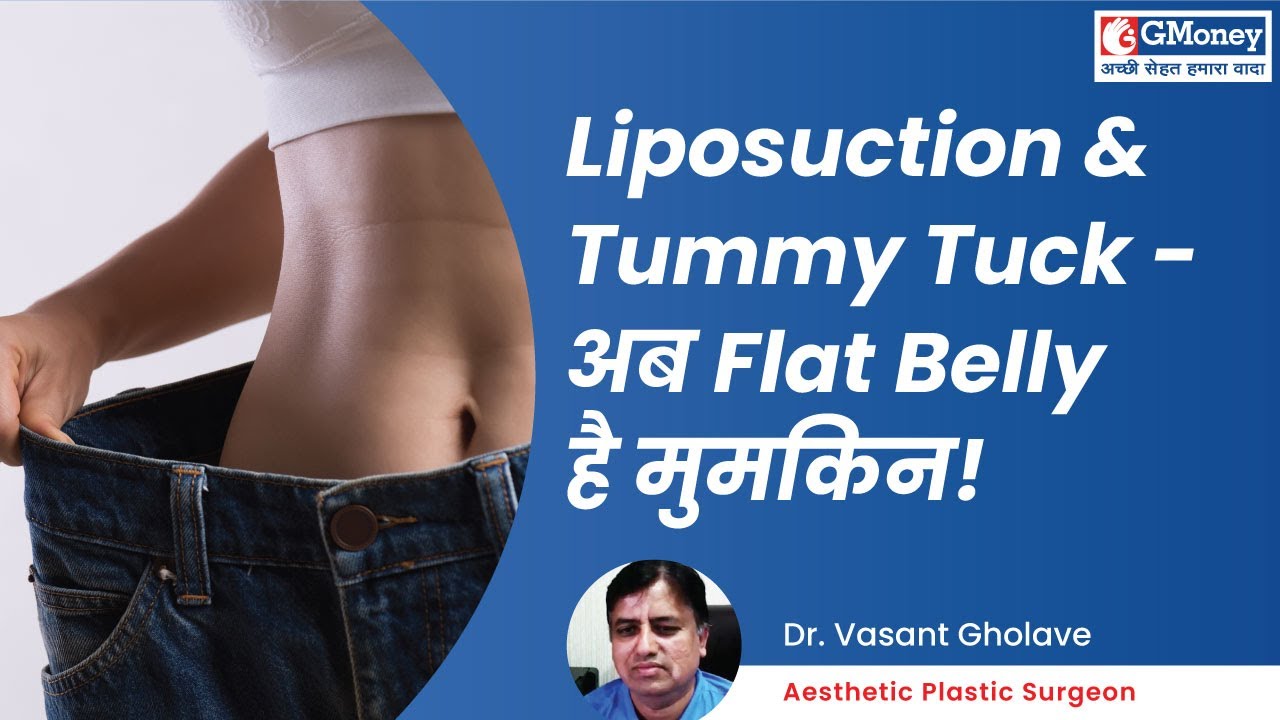 Is liposuction surgery safe? Lipoplasty & Body Contouring - GMoney ...