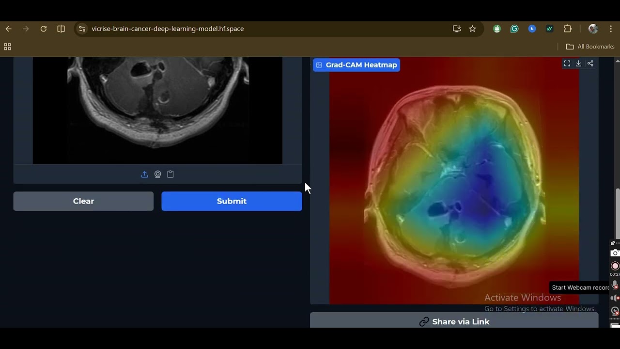 Deep learning based brain tumor MRI classification system with explainable AI using Grad-CAM ...