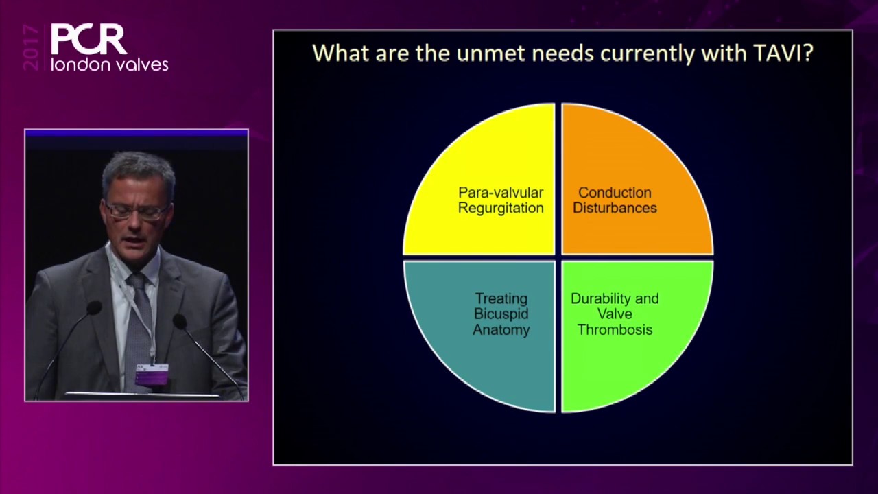 The Lotus Valve System: building the next chapter - PCR London Valves ...