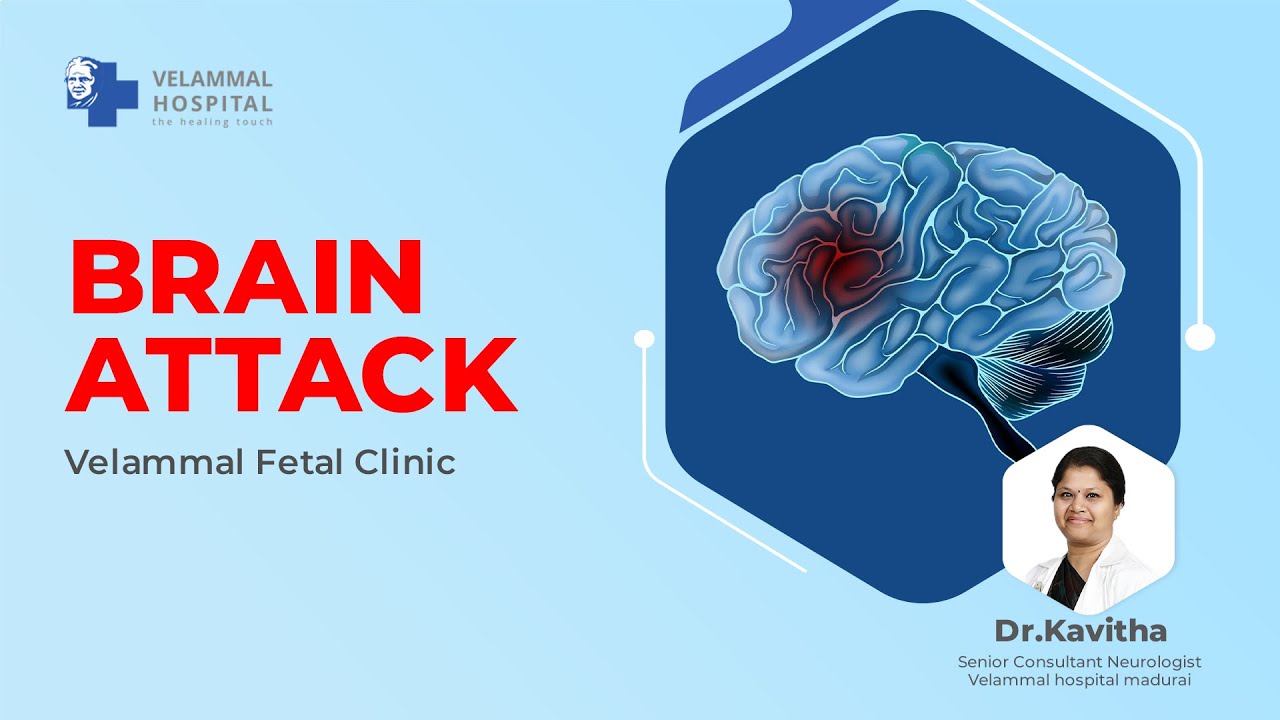 Brain Attack | Neurology |Velammal Hospital | Excellence in Healthcare ...