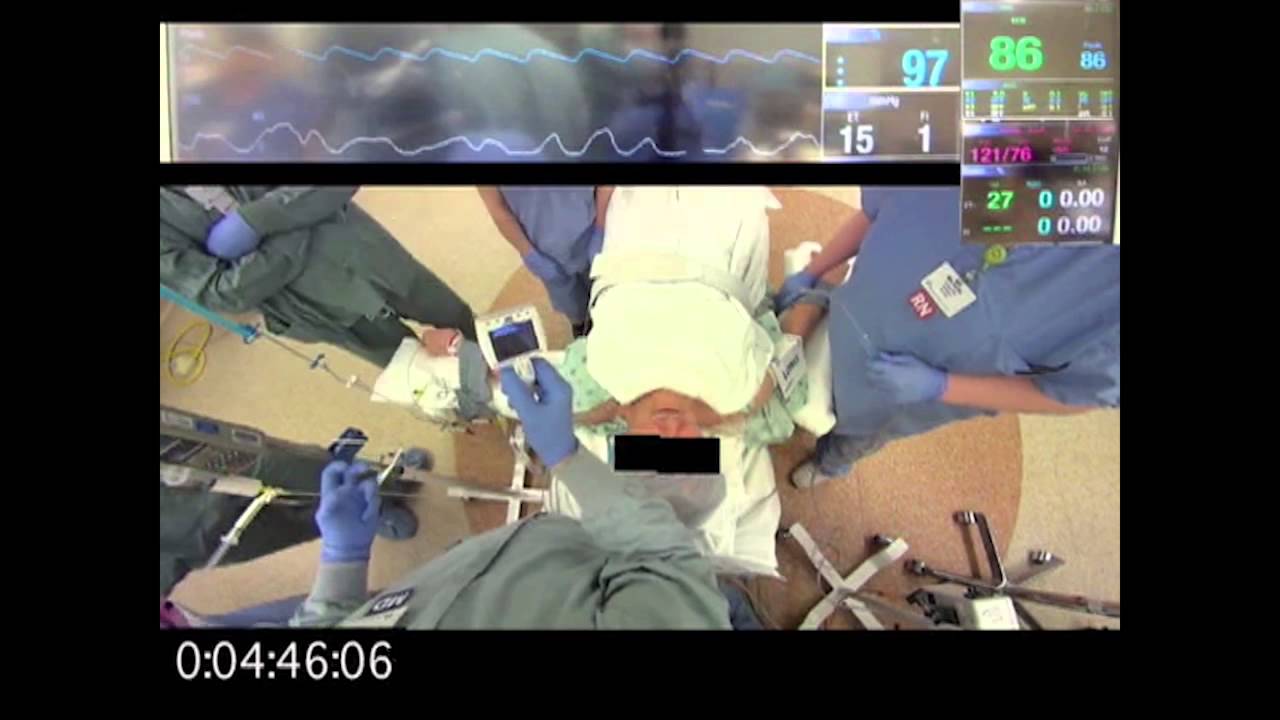 SH AincA Video Stylet - YouTube