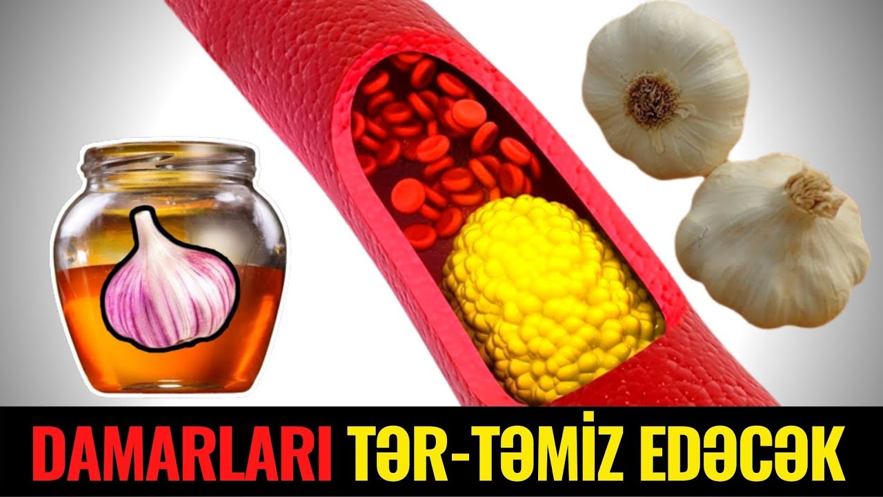 Damarlardakı Xolesterinin Təbii Yolla Müalicəsi - YouTube