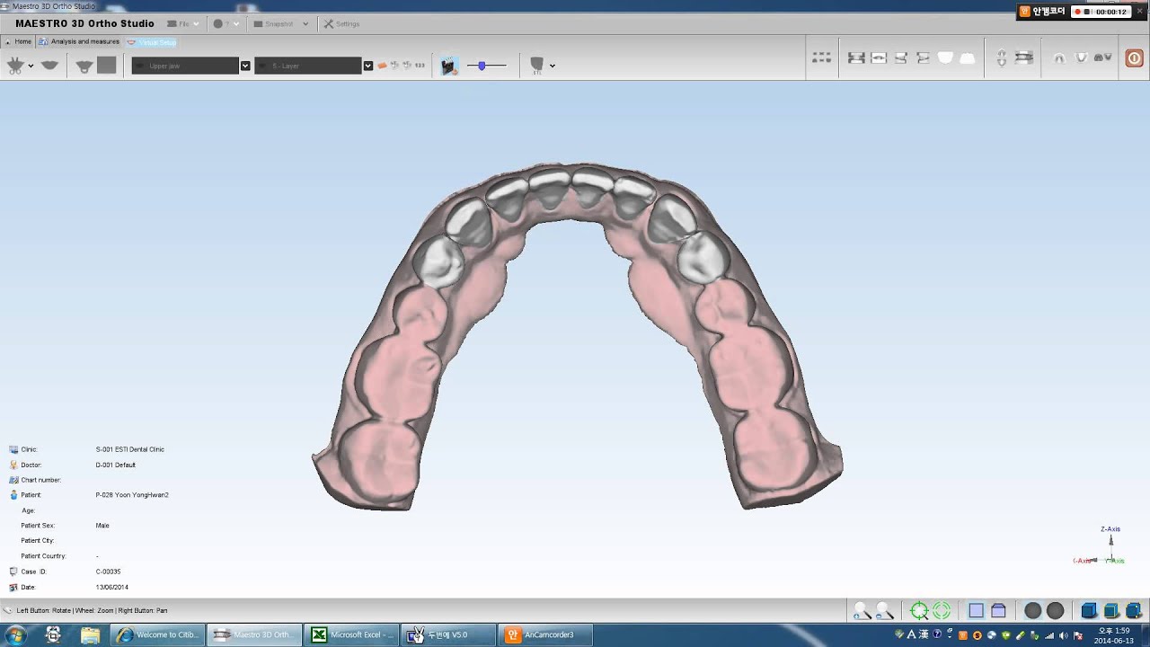 Smart Ortho - YouTube