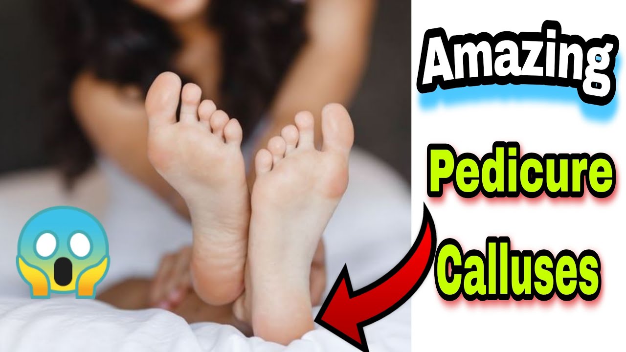 Create Pedicure Amazing video Before & After 🔥!! Footcare33 - YouTube