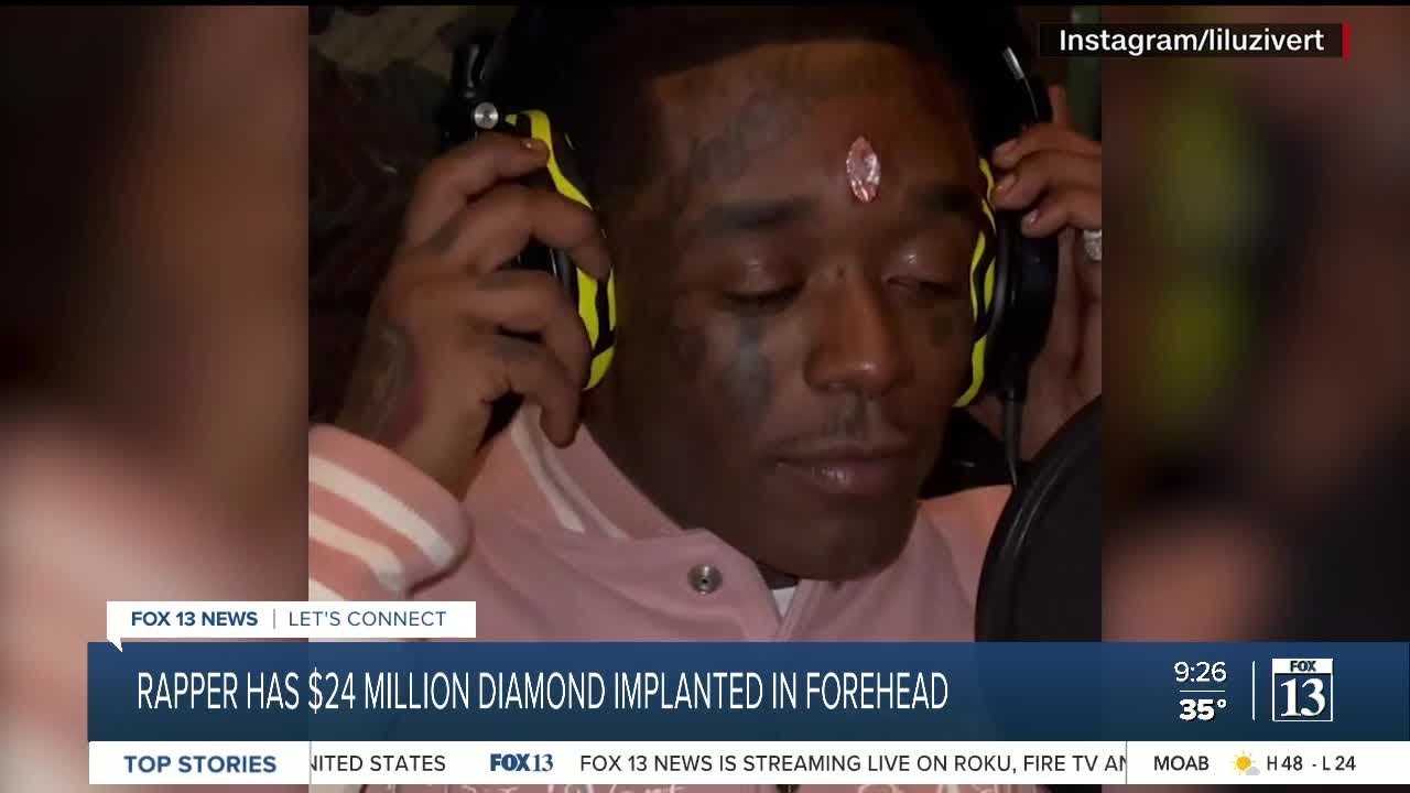 Rapper implants diamond in forehead - YouTube