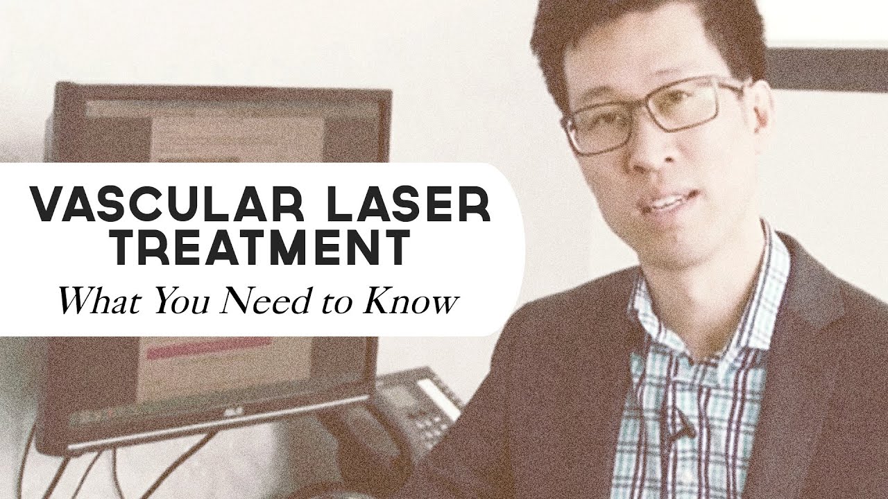 Vascular laser treatment - detailed explanation - YouTube