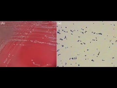 Streptococcus Equisimilis Subspecies Zooepidemicus ; Characteristics ...