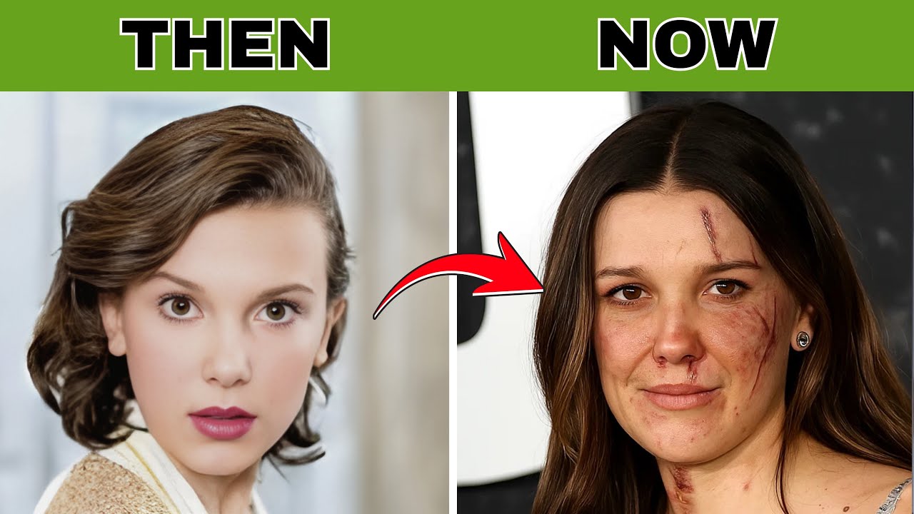 Stranger Things Cast | Then vs Now (2025) – Amazing Transformations ...