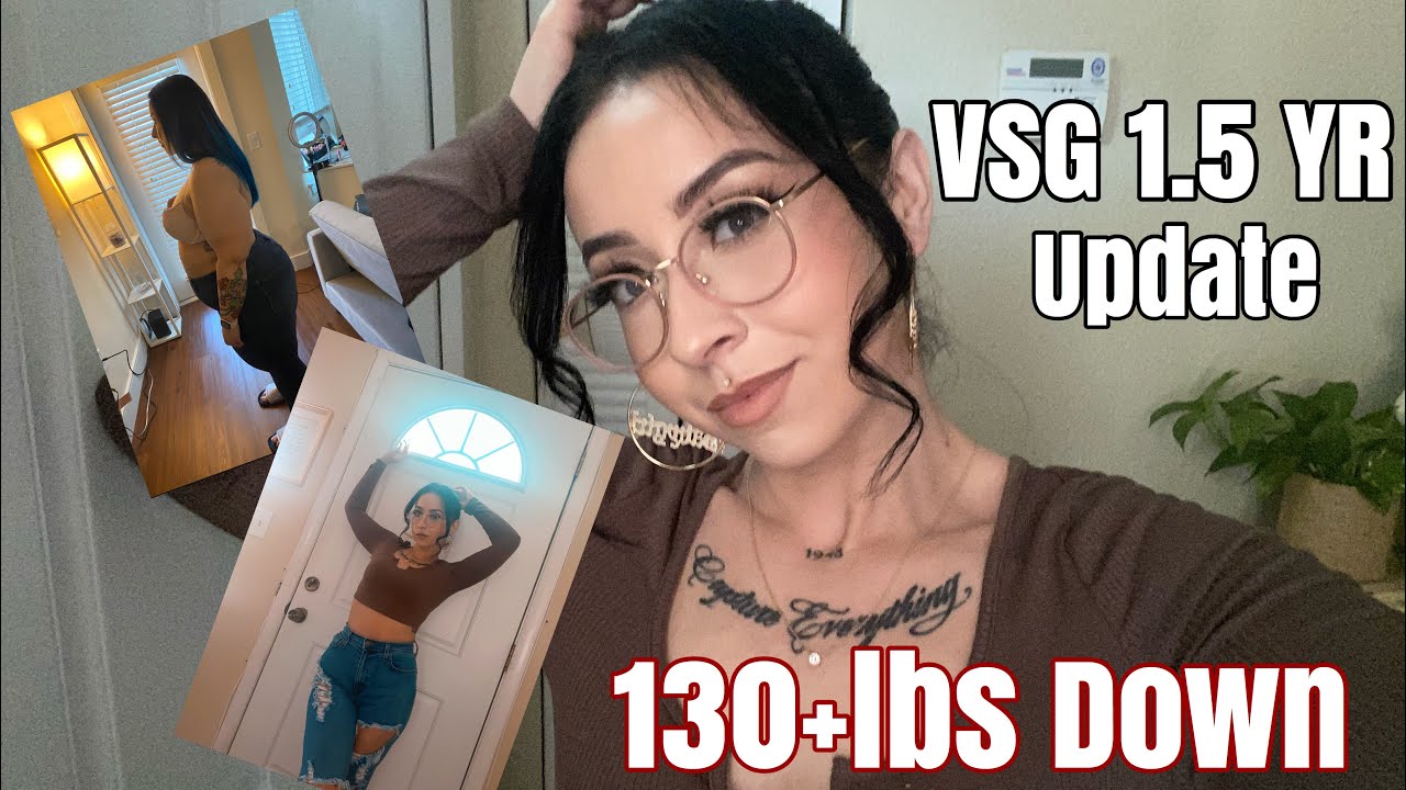 VSG 1.5 YEAR UPDATE FAQ | Loose skin, Mental Health, Exercise, What I ...