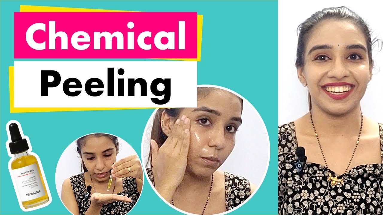 How to do chemicalpeeling? demo for chemical peeling. What is chemical ...