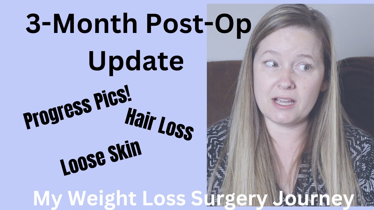 Month 3 Post-Op Update with Progress Pics - Gastric Bypass/RNY ...