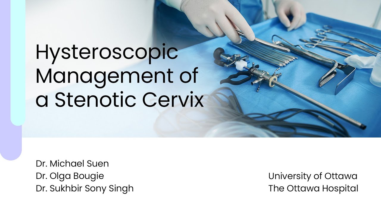 Hysteroscopic Management of a Stenotic Cervix - YouTube