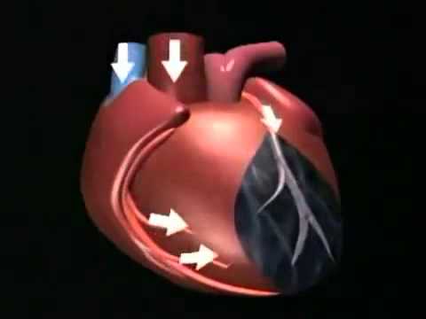 ECP Therapy - How it Works - YouTube