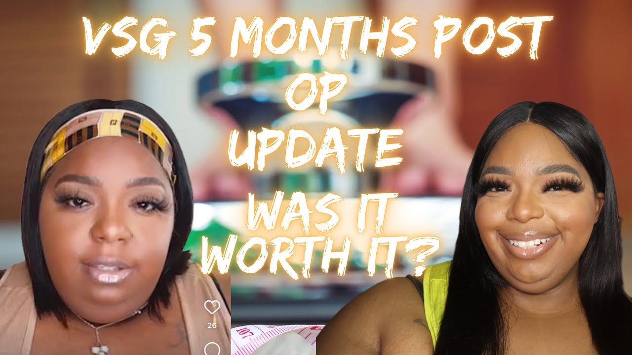 VSG 5 MONTHS POST OP UPDATE | Weight Loss Surgery - YouTube