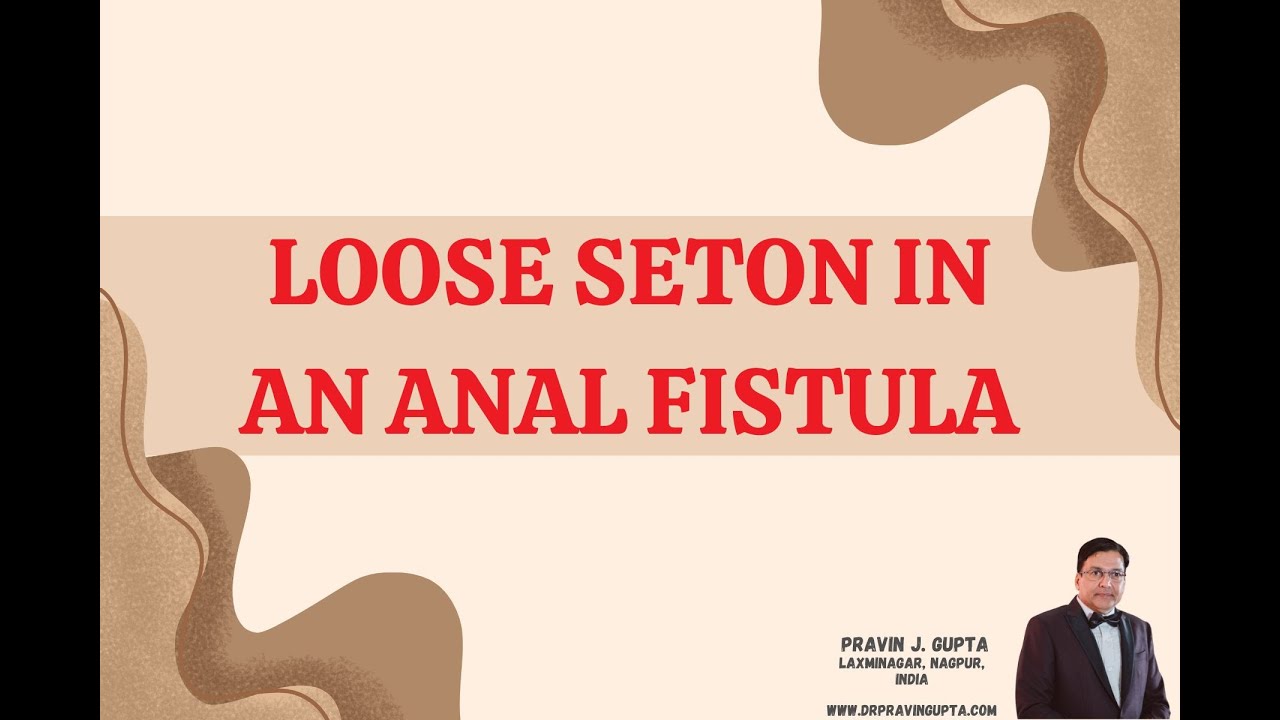 LOOSE SETON IN ANAL FISTULA - YouTube