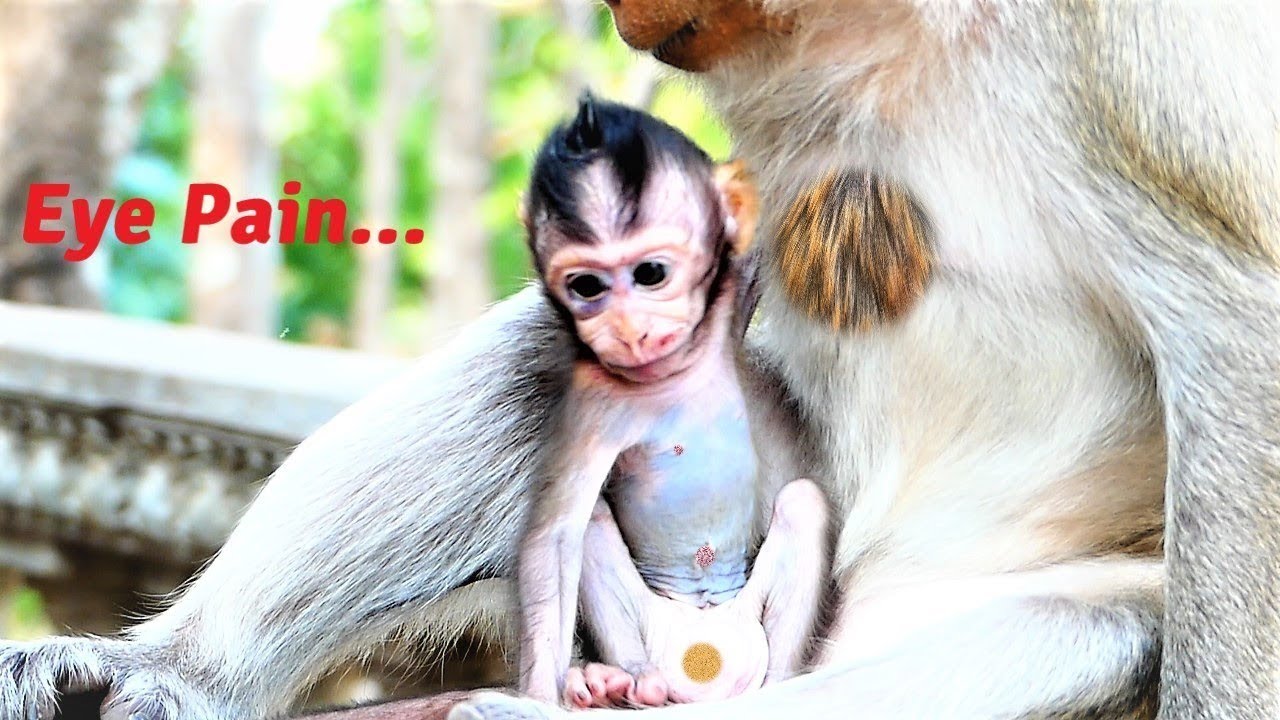 Cutie Baby Benny Screams due to He Suffers Too Much Hurt of Eye ...