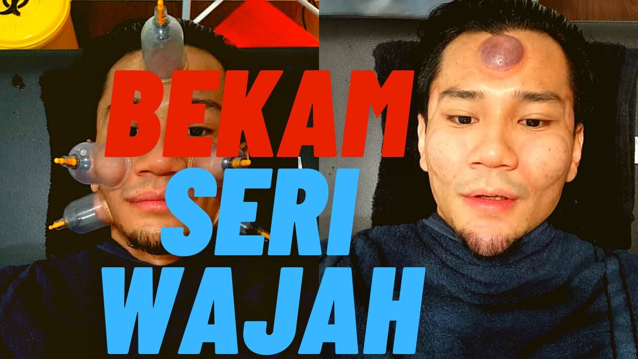 🔥PENGALAMAN BEKAM WAJAH SPA BEKAM ARRAYYAN - YouTube