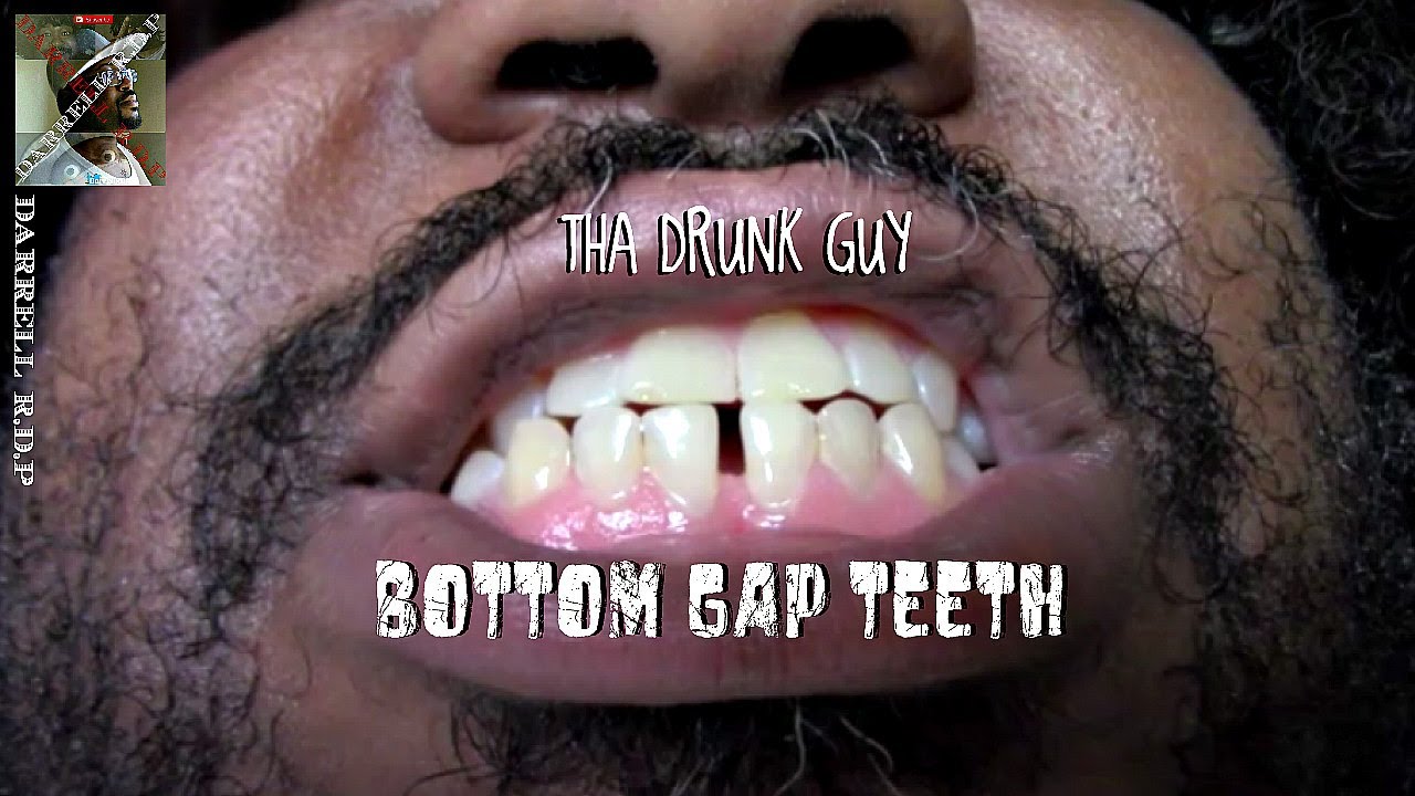 BOTTOM GAP TEETH - YouTube