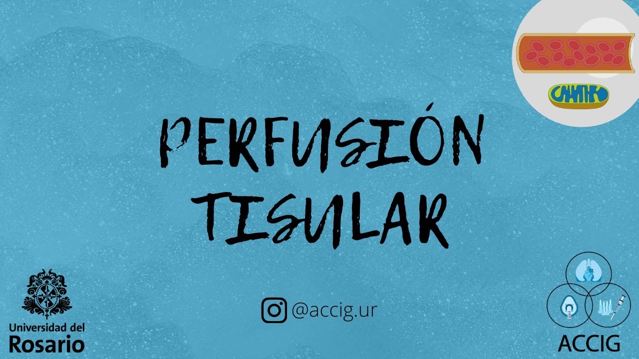 Perfusión tisular (Anesthesia And Critical Care Interest Group ...