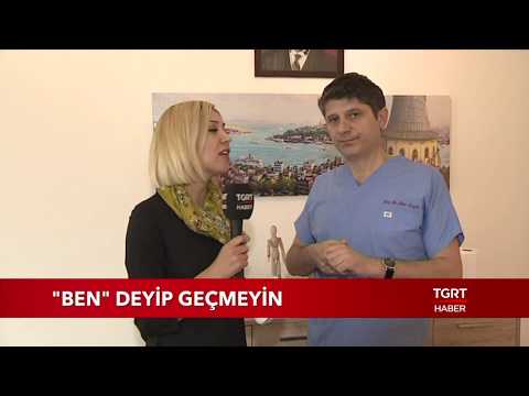 Vücuttaki Benler Cilt Kanseri Belirtisi Olabilir