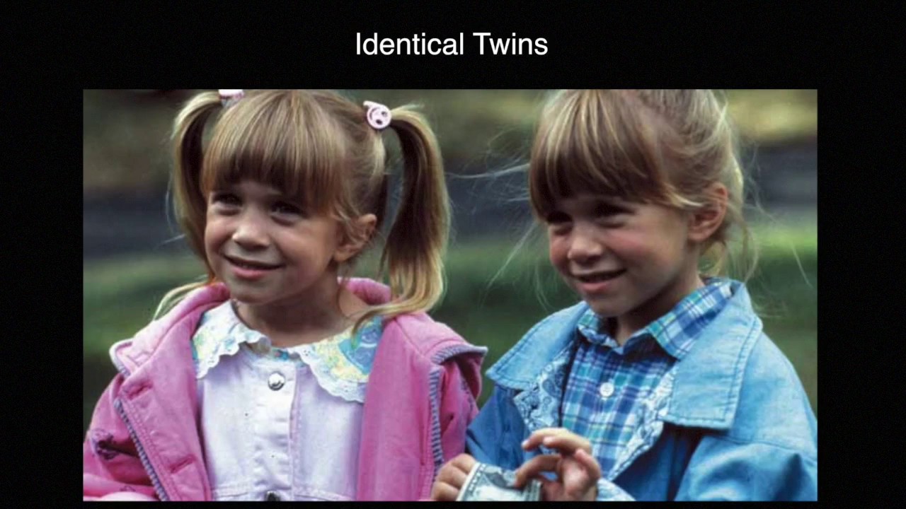 Jadon & Ainas McDonald: Conjoined Twins Separated! - YouTube