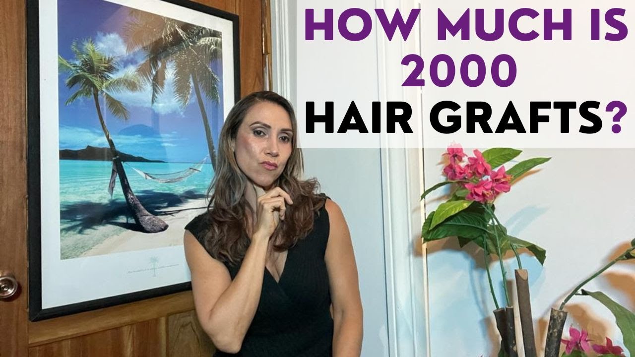How much is 2000 hair grafts? - YouTube