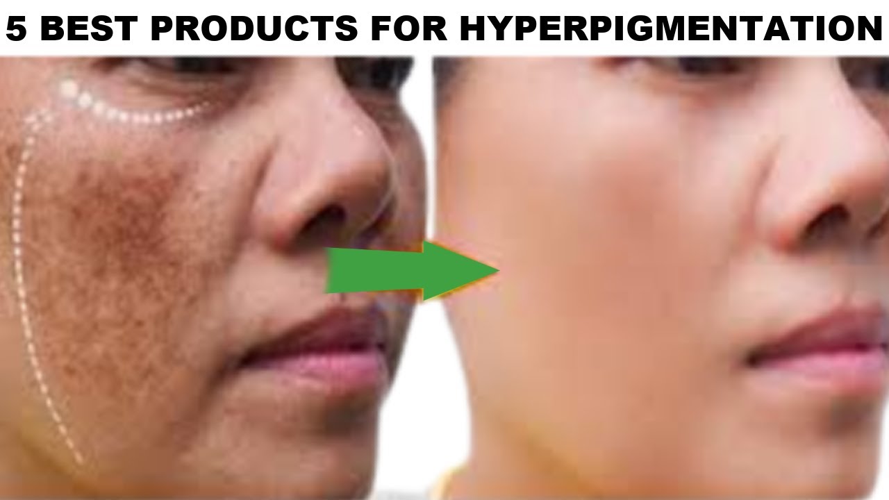 5 BEST PRODUCTS FOR HYPERPIGMENTATION + 5 FOR WRINKLES AND FINE LINES ...