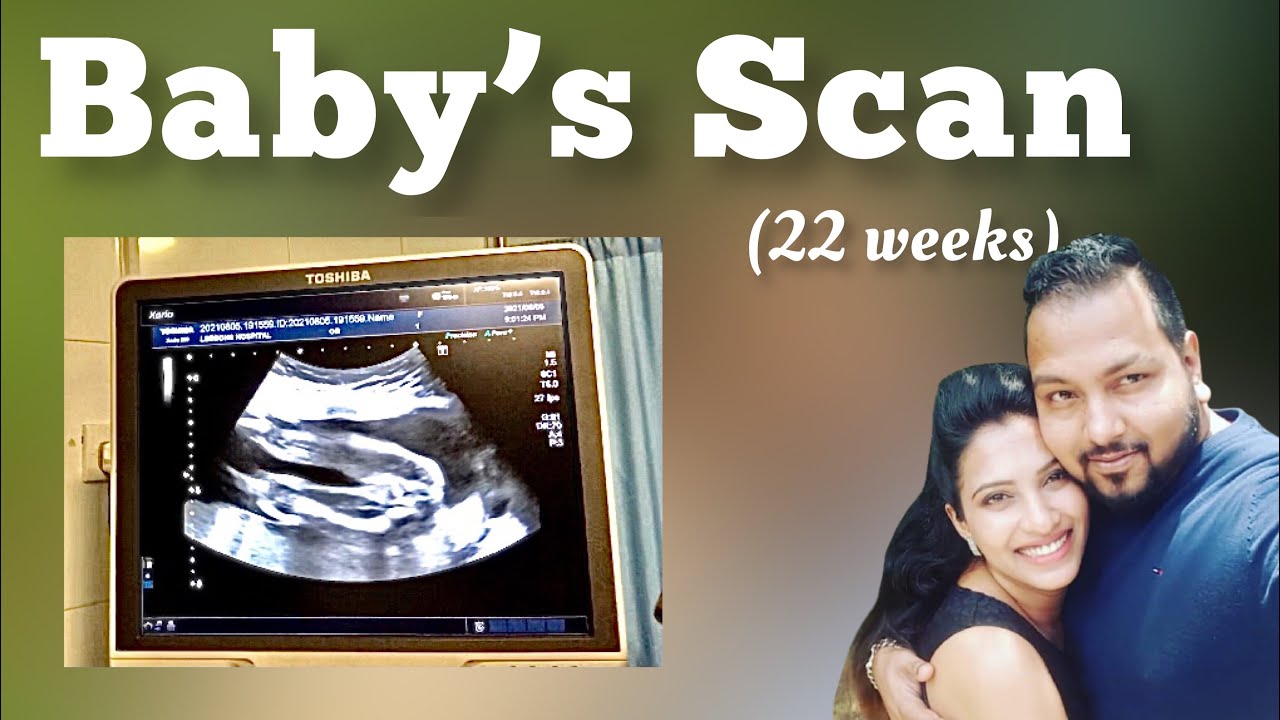 බබාගේ සම්පූර්ණ scan එක ප්‍රශ්න ගොඩකට පිලිතුරු එක්ක 👼 5 month scan 🌼 20 ...