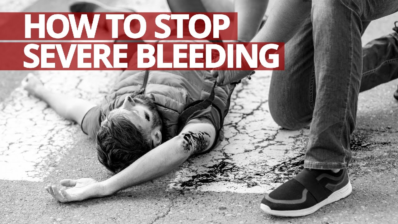 How to Stop Severe Bleeding #FirstAid #Lifesaver - YouTube