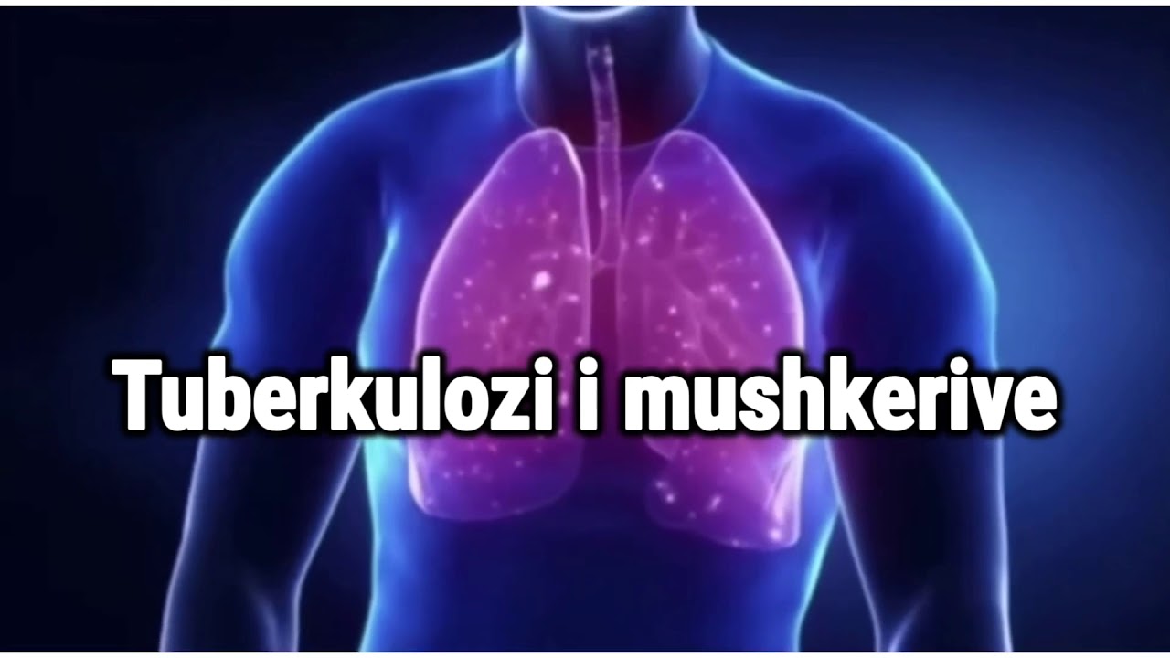 Tuberkulozi i mushkerive - YouTube