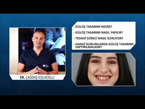 Gülüş Tasarımı - Çağdaş Kışlaoğlu - Estetik Diş Hekimi