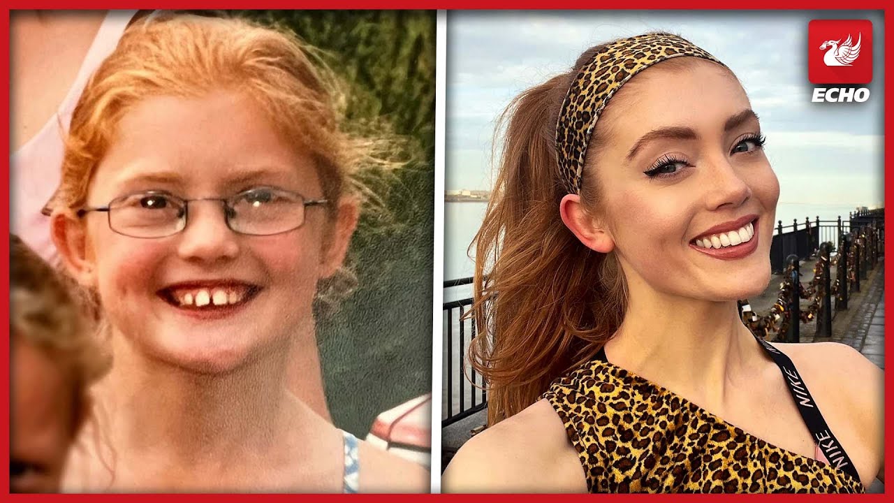 Woman 'spat at' for being ginger crowned Miss England - YouTube